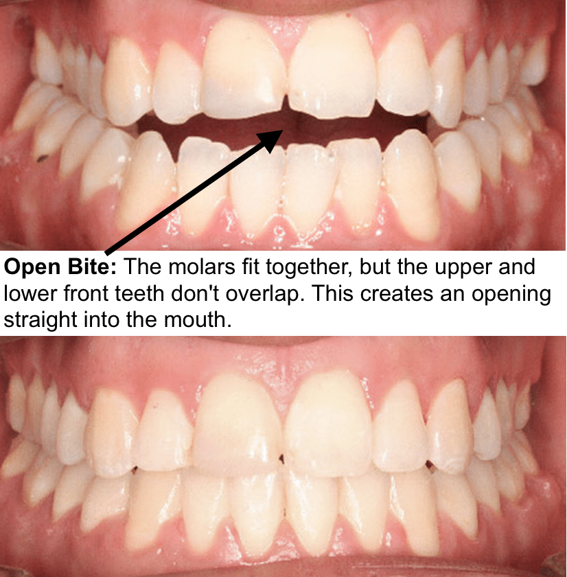 Jaw Surgery Archives - Larry M. Wolford, DMD