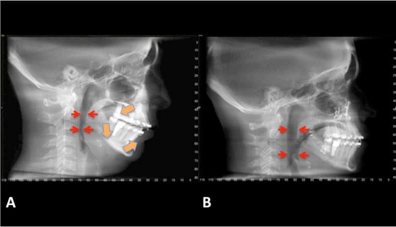 head and face measurements