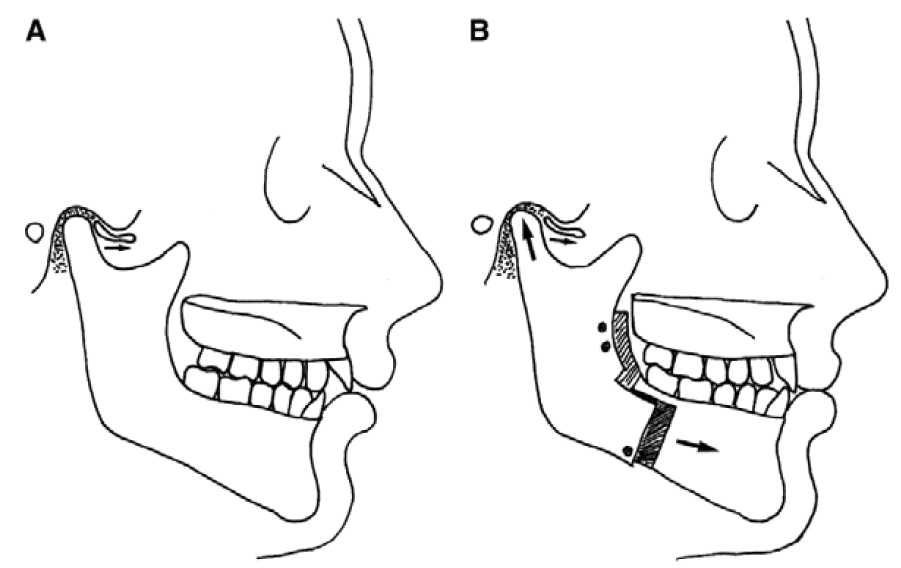 Comprehensive Diagnostic List and Treatment Plan for TMJ Surgery ...