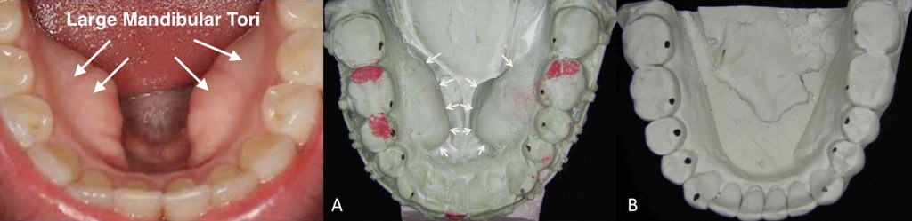 Surgical Management of Nasal Airway Obstruction - Larry M. Wolford, DMD