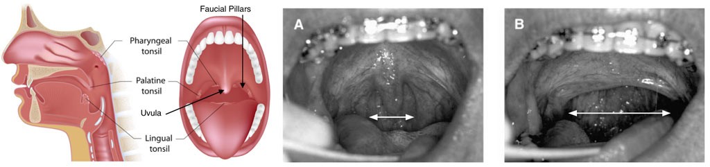 Surgical Management of Nasal Airway Obstruction - Larry M. Wolford, DMD